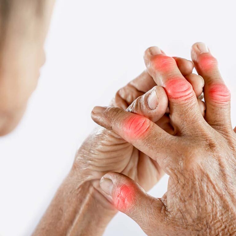 Emkey Arthritis & Osteoporosis Clinic